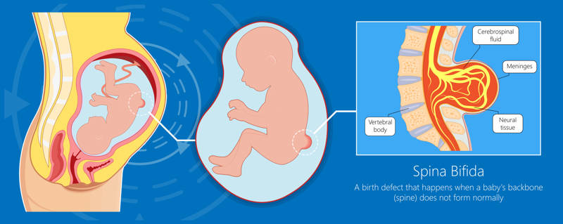 Por que razão não têm os grandes símios cauda? Parasita genético pode ...