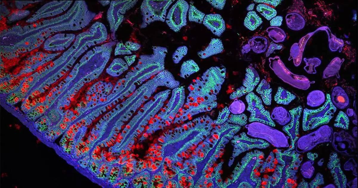 Um Atlas das Células Humanas? Já estivemos mais longe