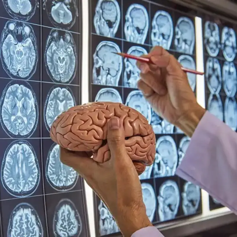 'Síndrome da cabeça explosiva’? Conheça este distúrbio do sono ...